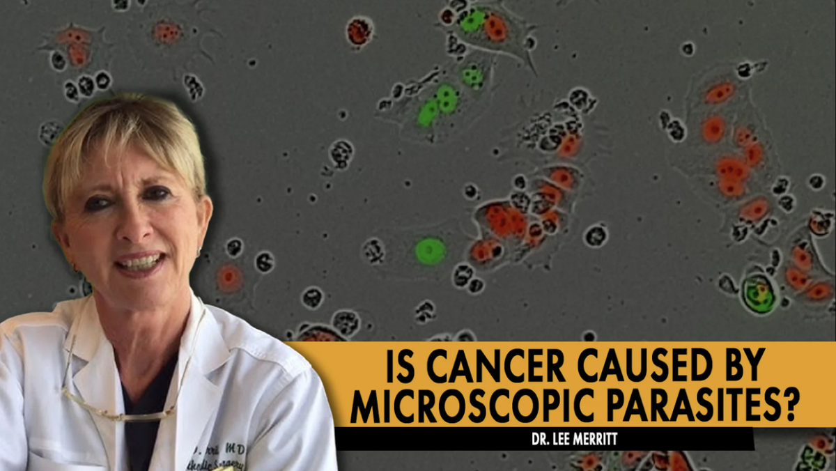 Mind Blowing: Micro-Parasites Cause Cancer And SO MANY OTHER ILLNESSES